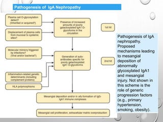Ig A nephropathy | PPTX