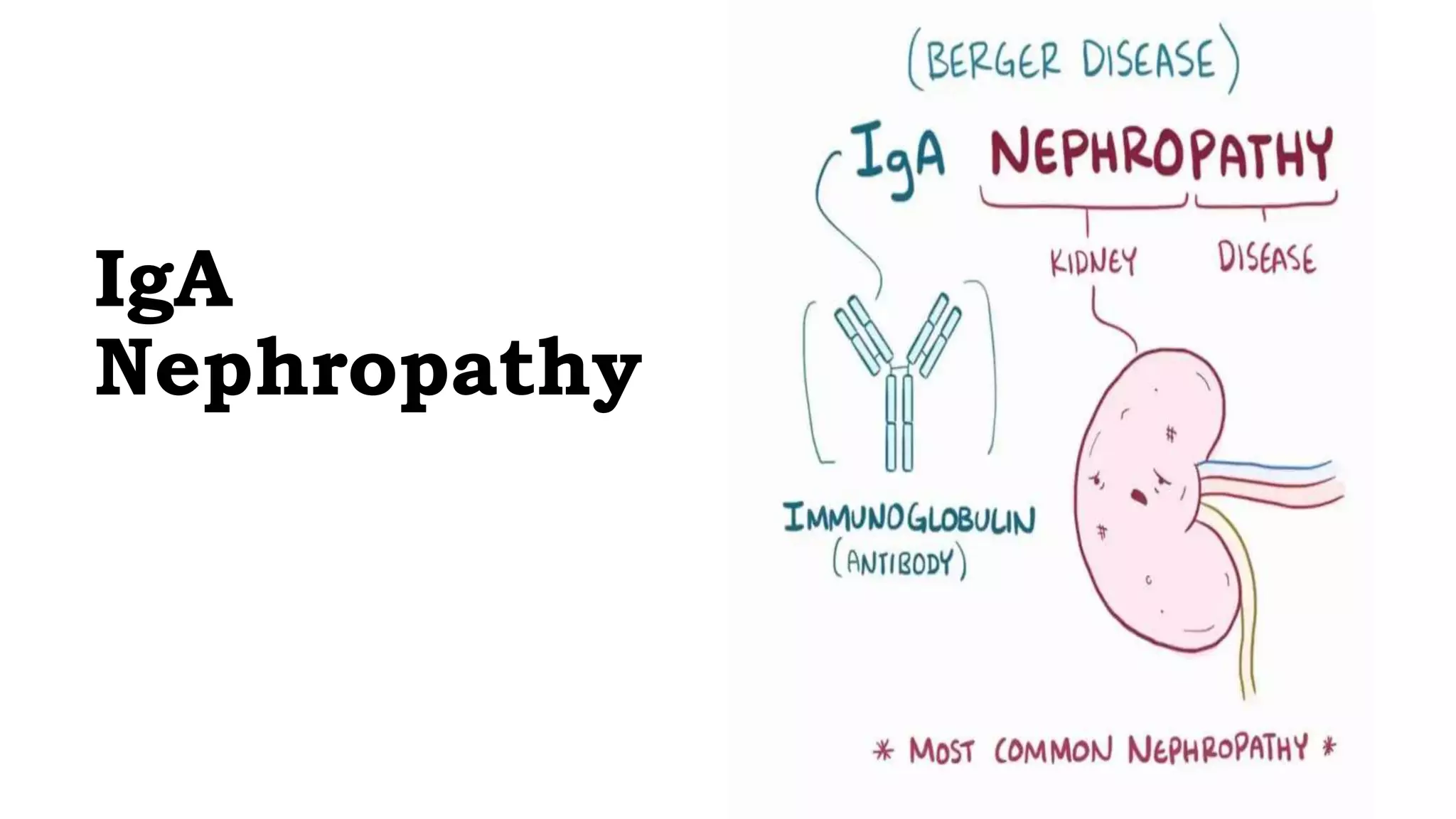 IgA nephropathy | PPTX