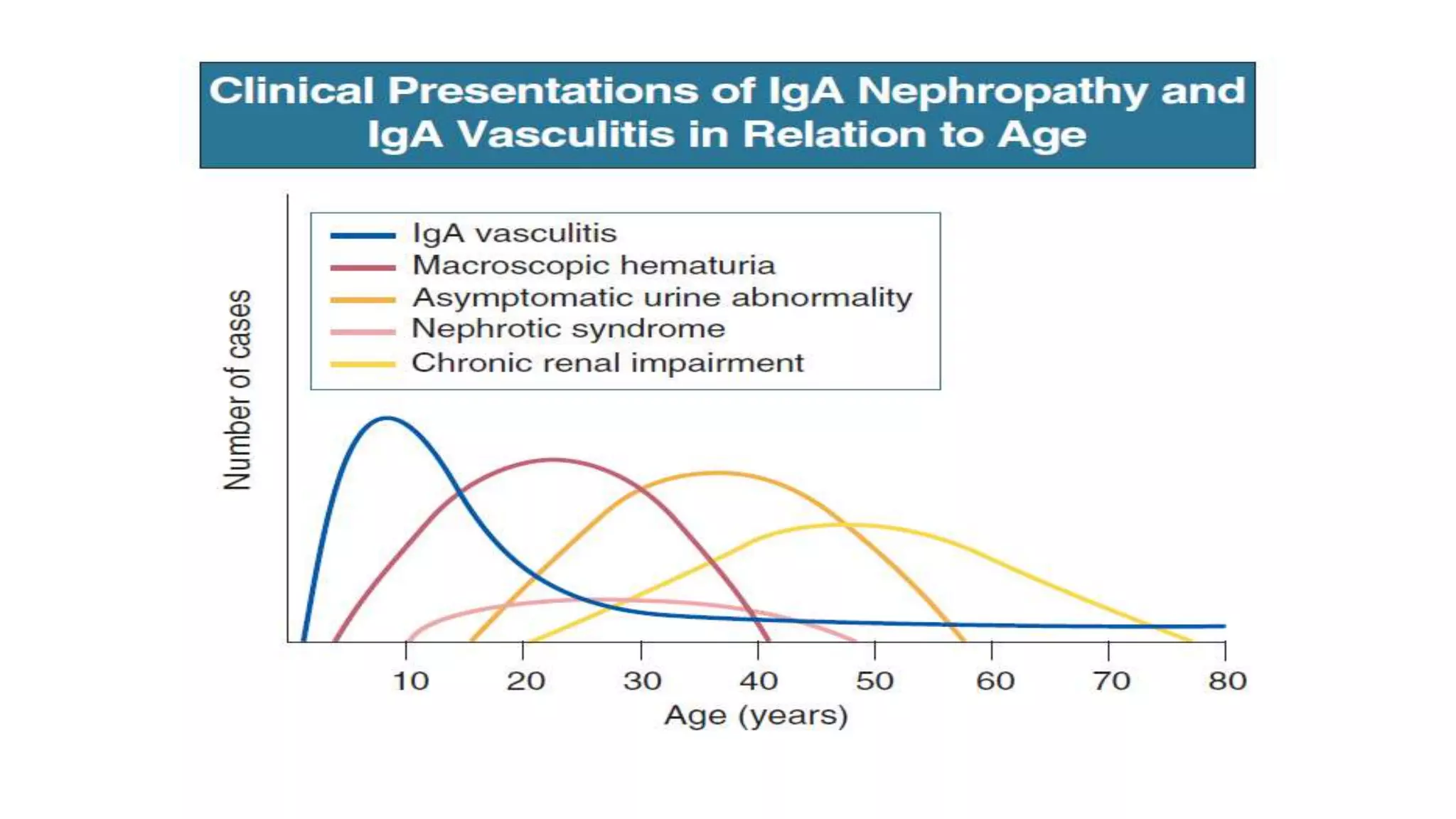 IgA nephropathy | PPTX
