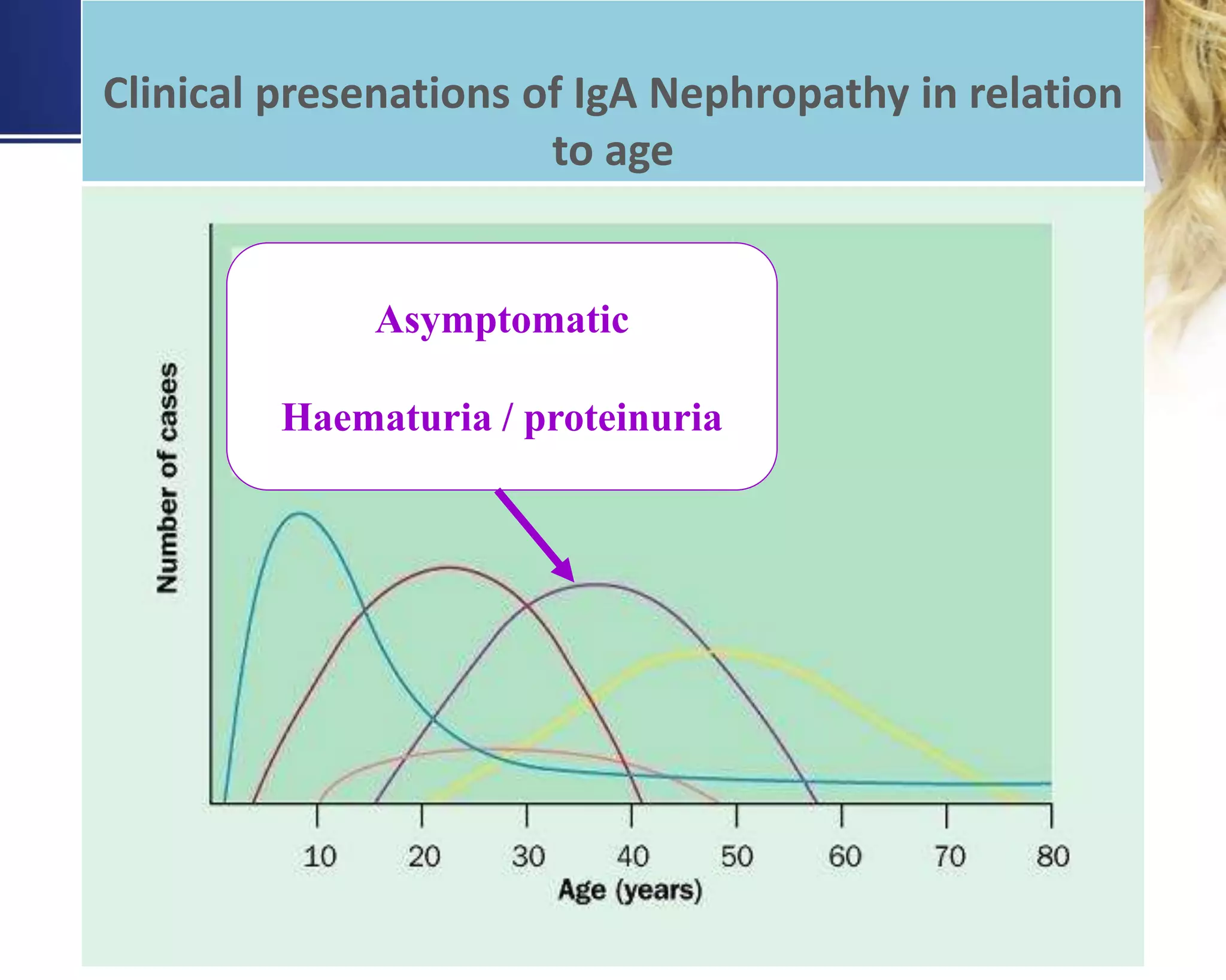 Ig A nephropathy (Cresentric) by Dr. Shami (SKIMS) | PPTX