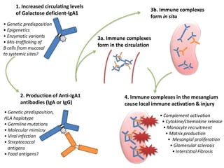 IgA Nephropathy Final.pptx
