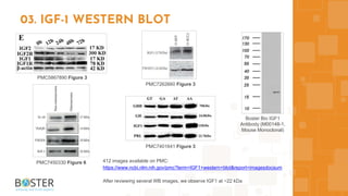 Learn IGF-1 in 3 minutes | Insulin-like growth factor I | PPTX