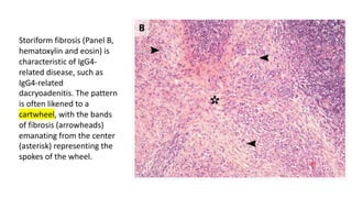 IgG4-Related Disease | PDF