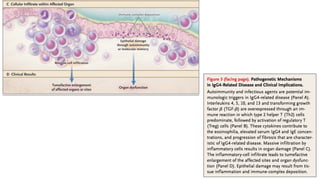 IgG4-Related Disease | PDF