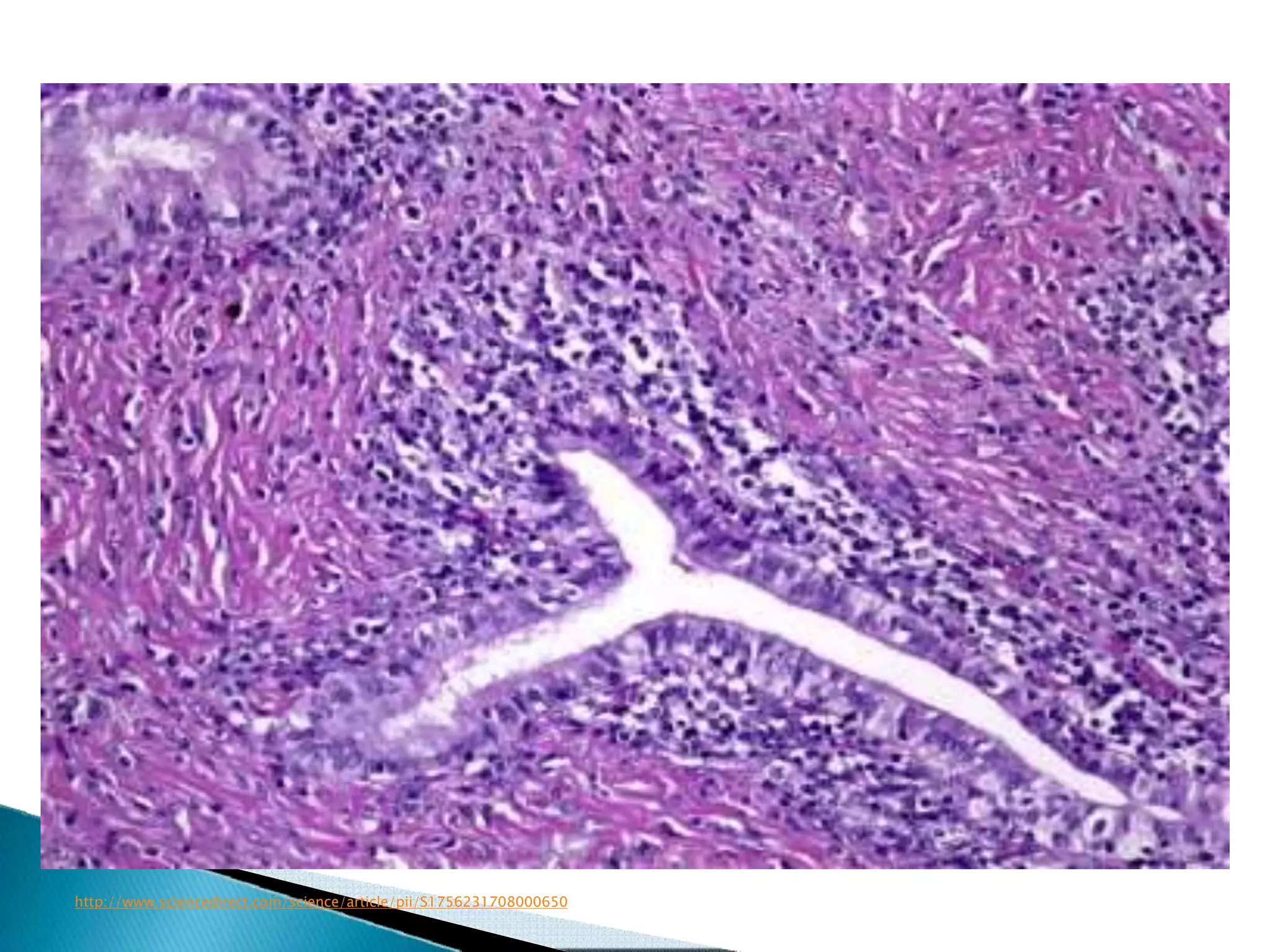 IgG4-Related Disease - Lam.pptx