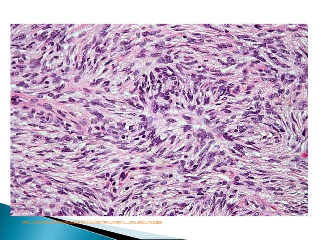 IgG4-Related Disease - Lam.pptx