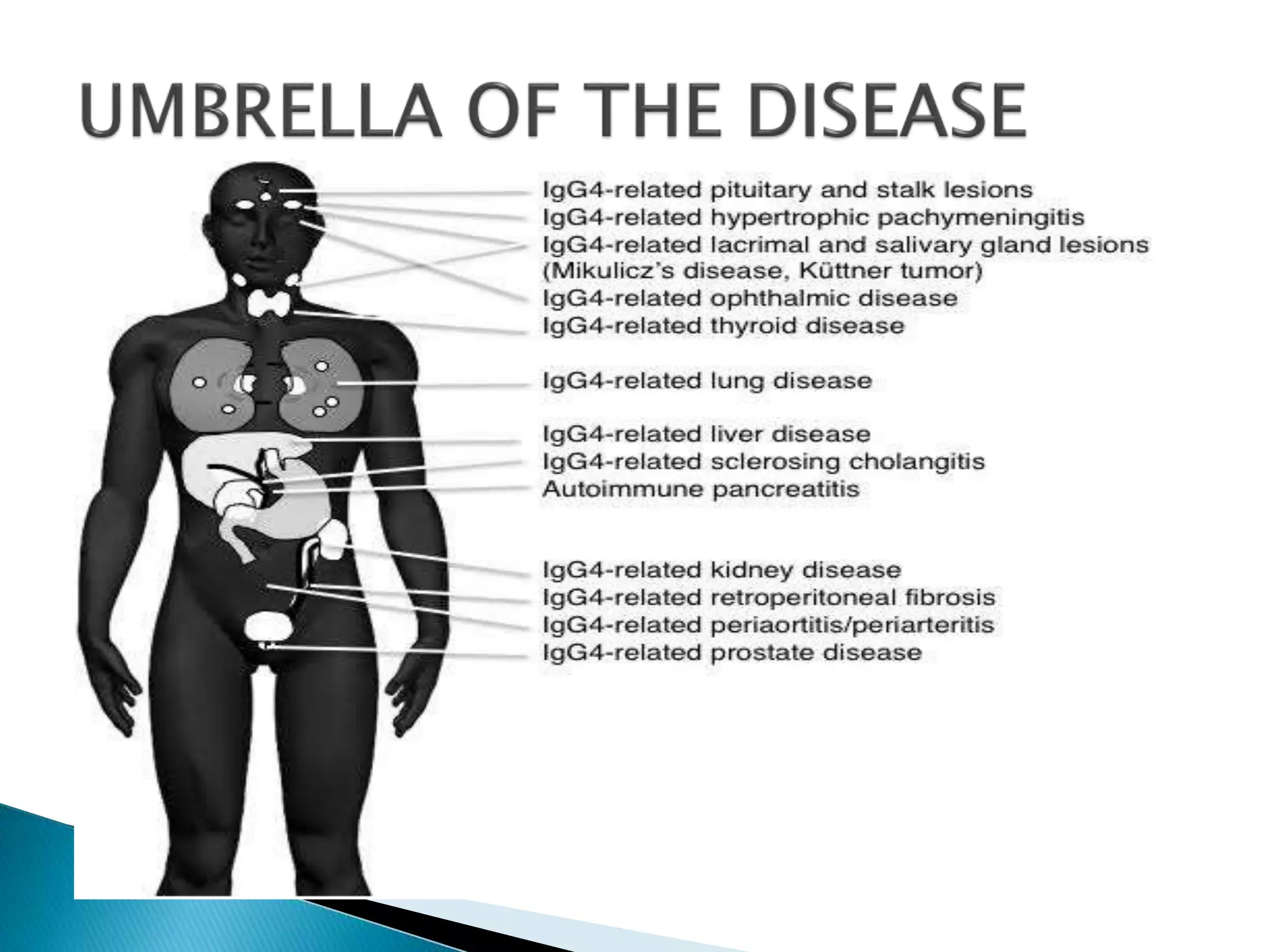 IgG4 RELATED DISEASES.pptx