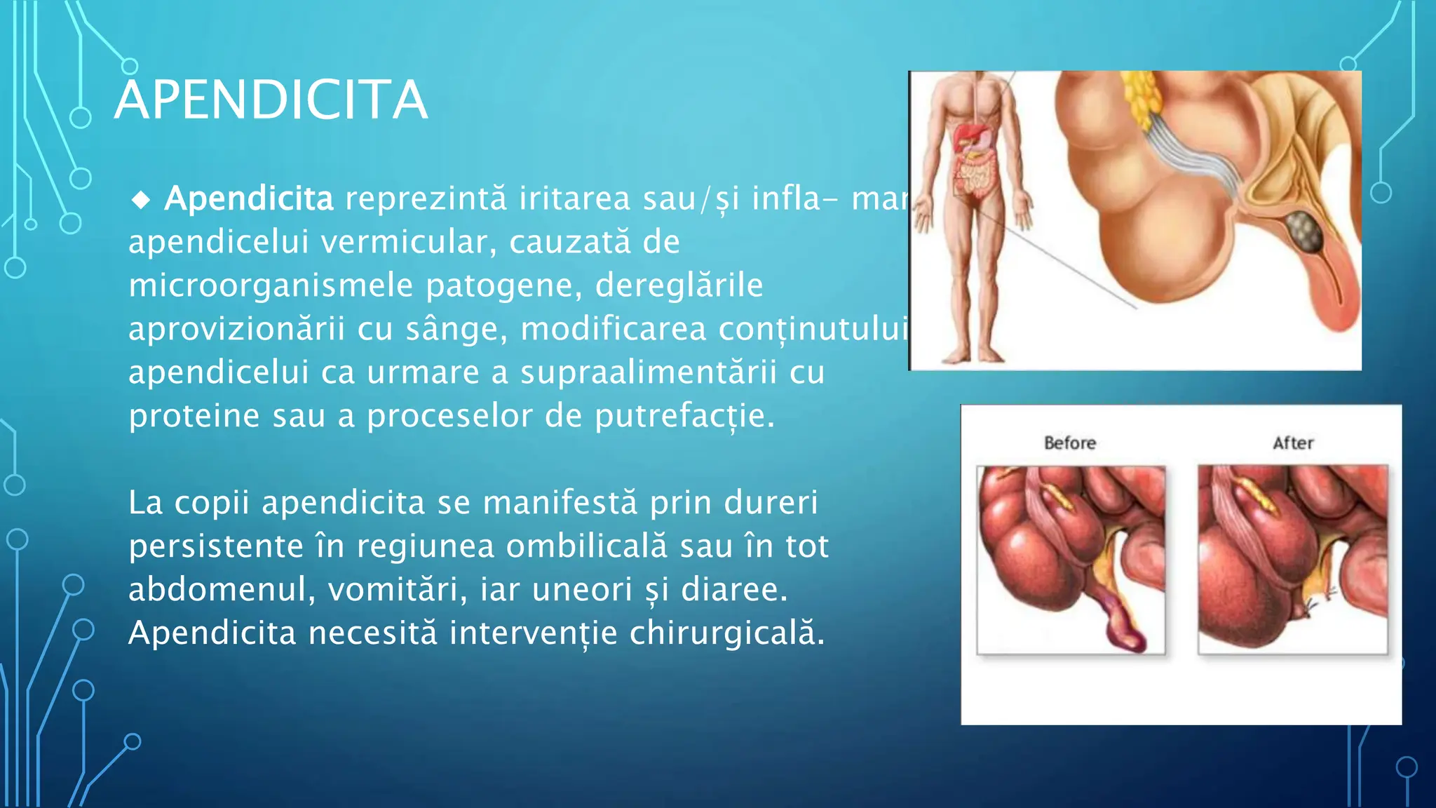 Igiena sistemului digestiv , biologi clasa 11-a | PPTX