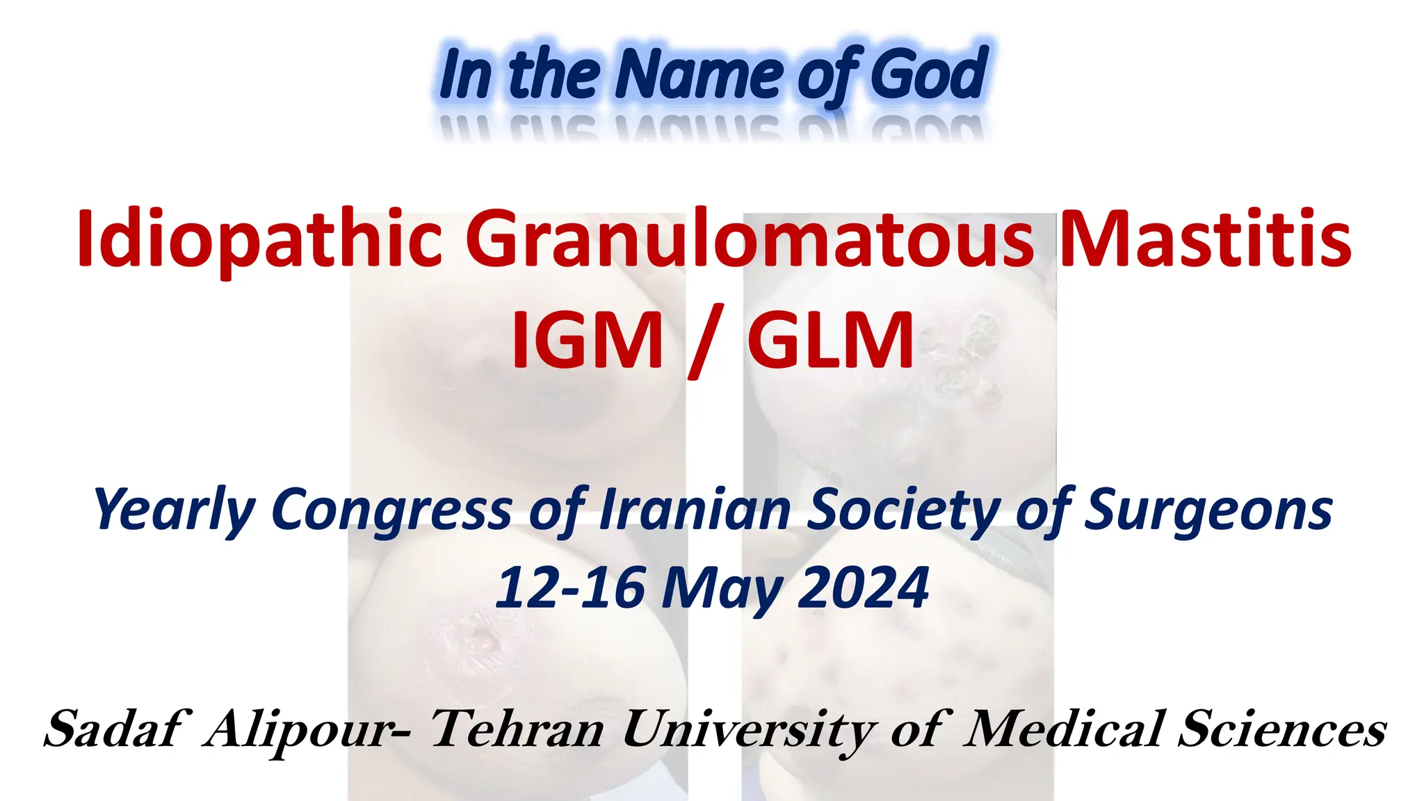 Idiopathic Granulomatous Mastitis- Granulomatous Lobular Mastitis ...