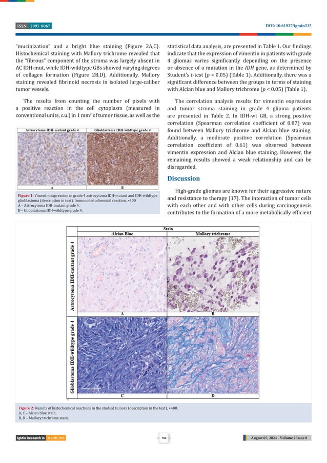 Impact of IDH1 Mutations on Stromal Histology in High-Grade Gliomas | PDF