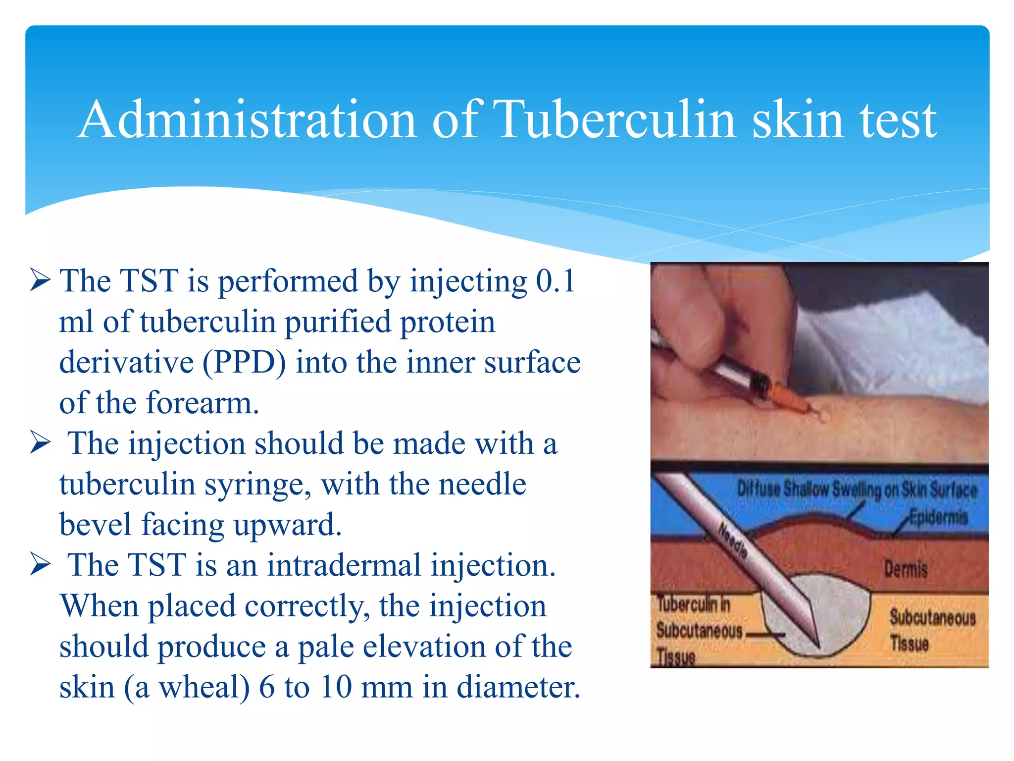 IGRA / TUBERCULIN SKIN TEST. | PPTX