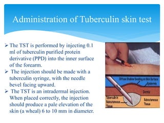 IGRA / TUBERCULIN SKIN TEST. | PPTX