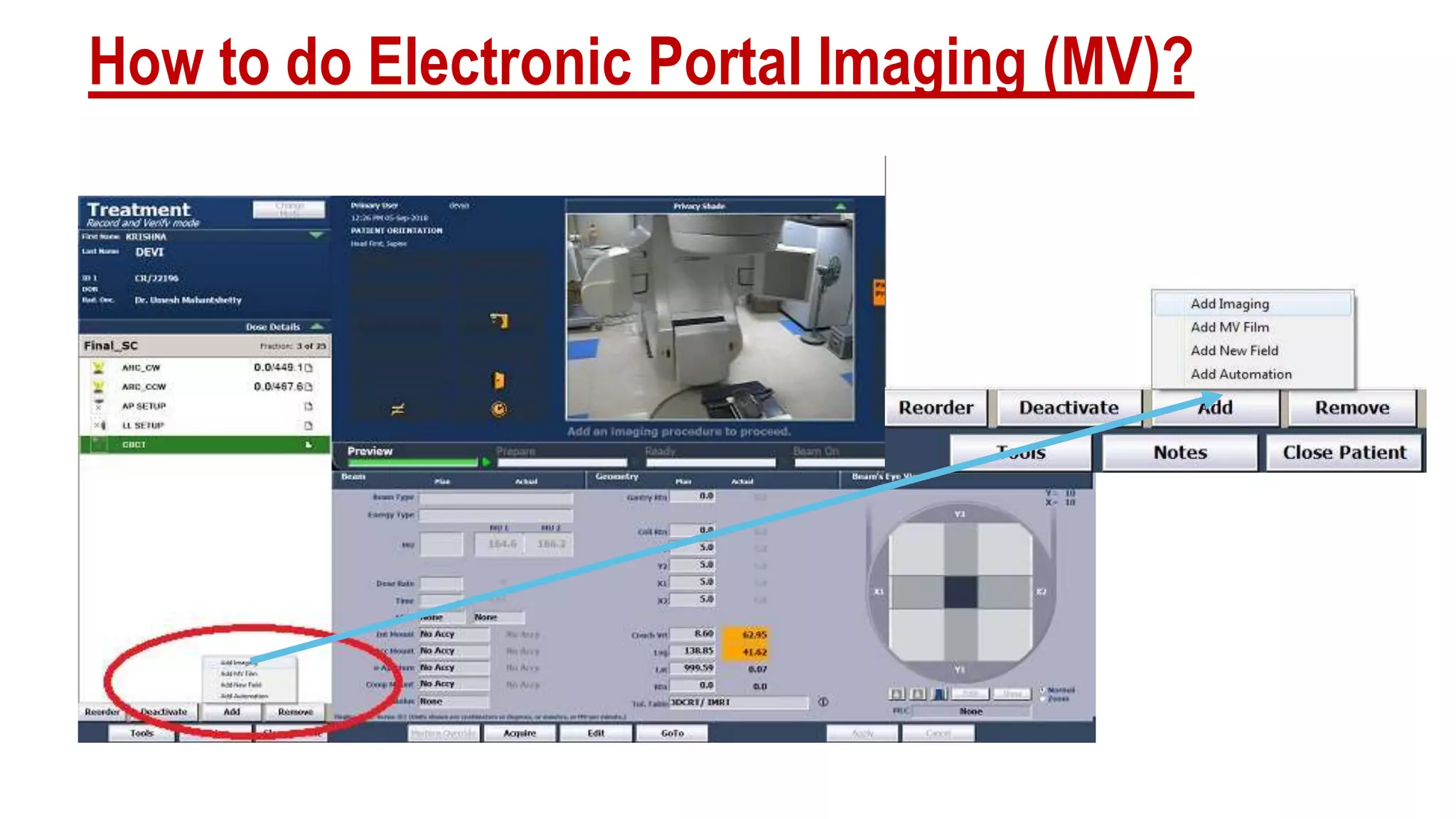 Image Guided Radiotherapy | PPTX
