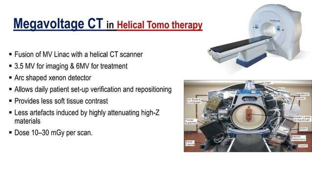 Image Guided Radiotherapy | PPTX