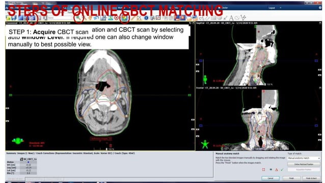Image Guided Radiotherapy | PPTX