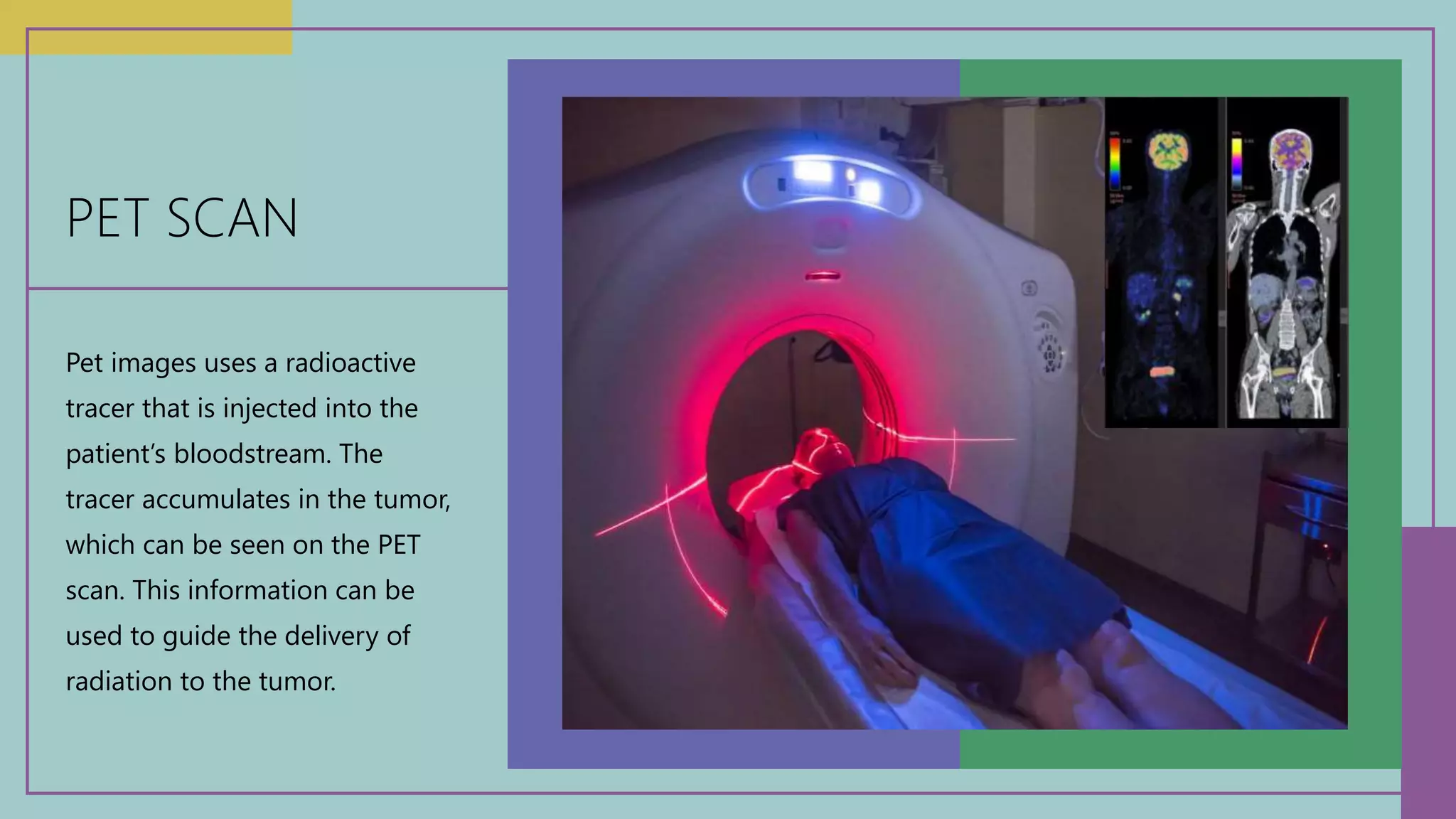 IGRT - Image Guided Radiotherapy Technique.pptx