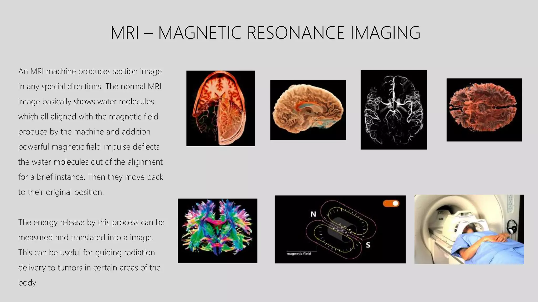 IGRT - Image Guided Radiotherapy Technique.pptx
