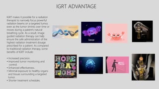 IGRT - Image Guided Radiotherapy Technique.pptx