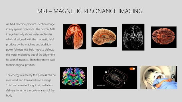IGRT - Image Guided Radiotherapy Technique.pptx | Cancer | Diseases and ...