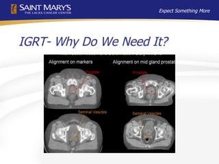 Igrt And Resp Gating Final Version | PPT | Medical Tests | Medical Health
