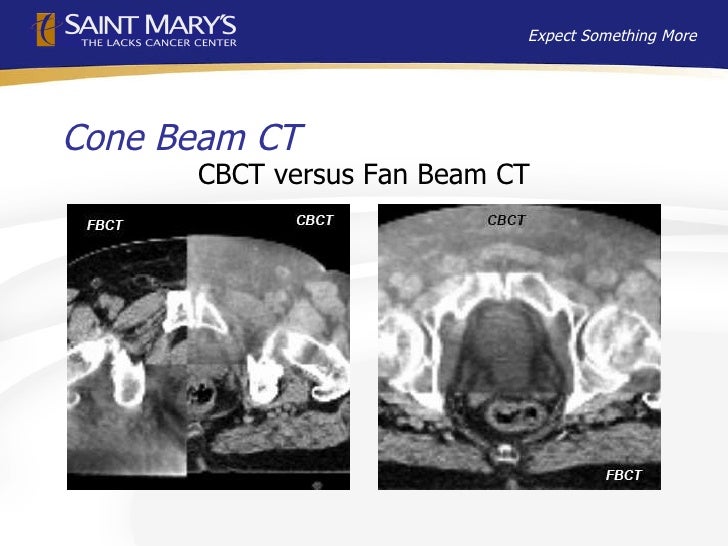 Igrt And Resp Gating Final Version