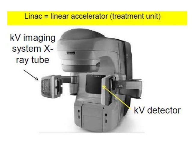 RAPIDARC- NEW ERA IN RADIOTHERAPY