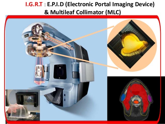 RAPIDARC- NEW ERA IN RADIOTHERAPY
