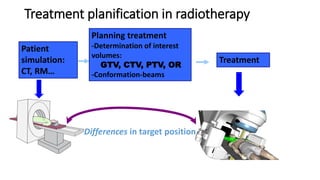 Image Guided Radiation Therapy (IGRT) | PDF