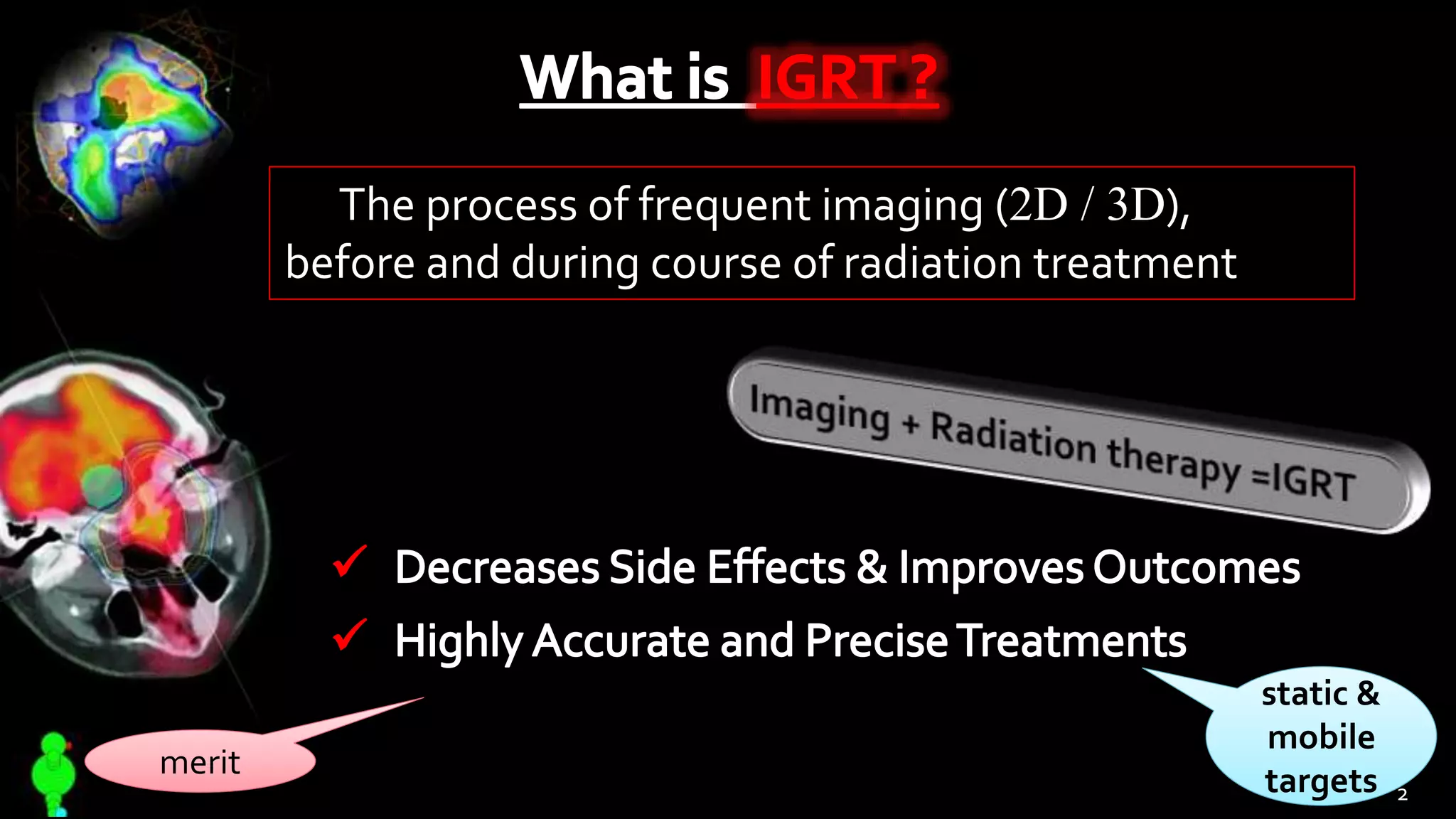 Image guided radiation therapy (IGRT) | PPTX