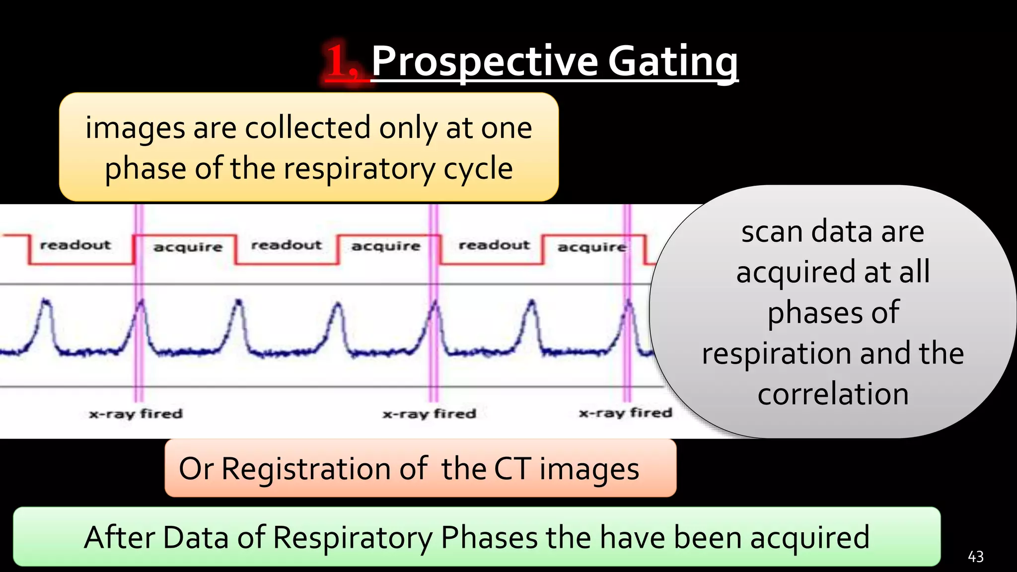 Image guided radiation therapy (IGRT) | PPTX
