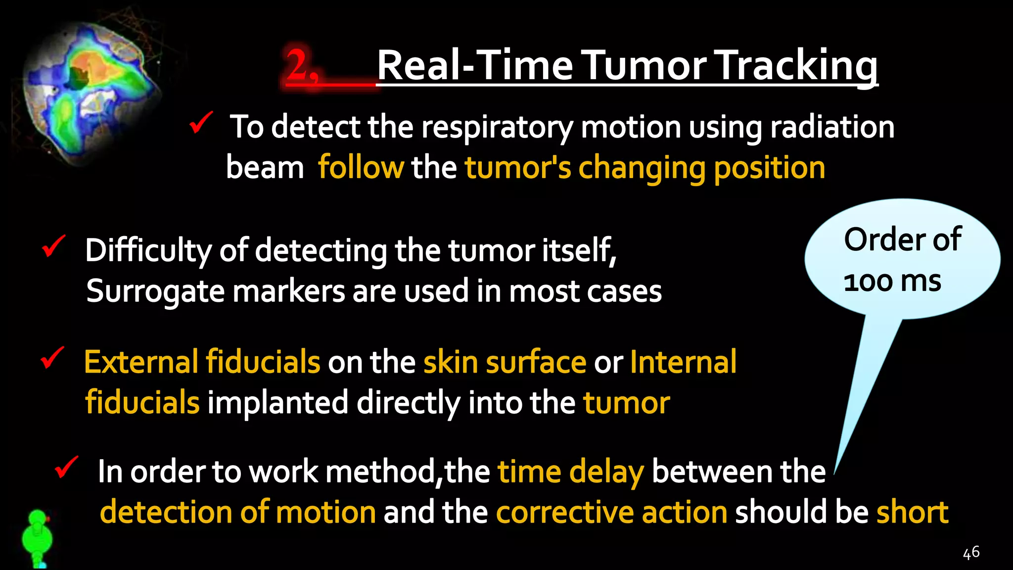 Image guided radiation therapy (IGRT) | PPTX