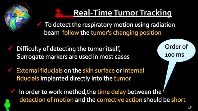 Image guided radiation therapy (IGRT) | PPTX | Physical Therapy | Wellness