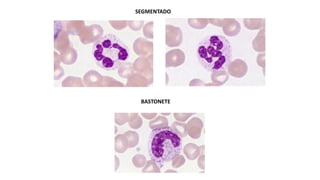 Hematologia_clinica_e_laboratorial_dos_leucocitos_III.pdf