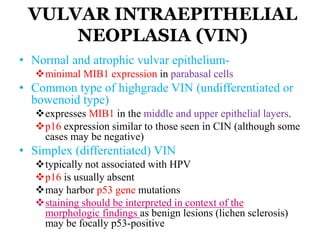 Immunohistochemistry in Gynaecological Cancers | PPTX
