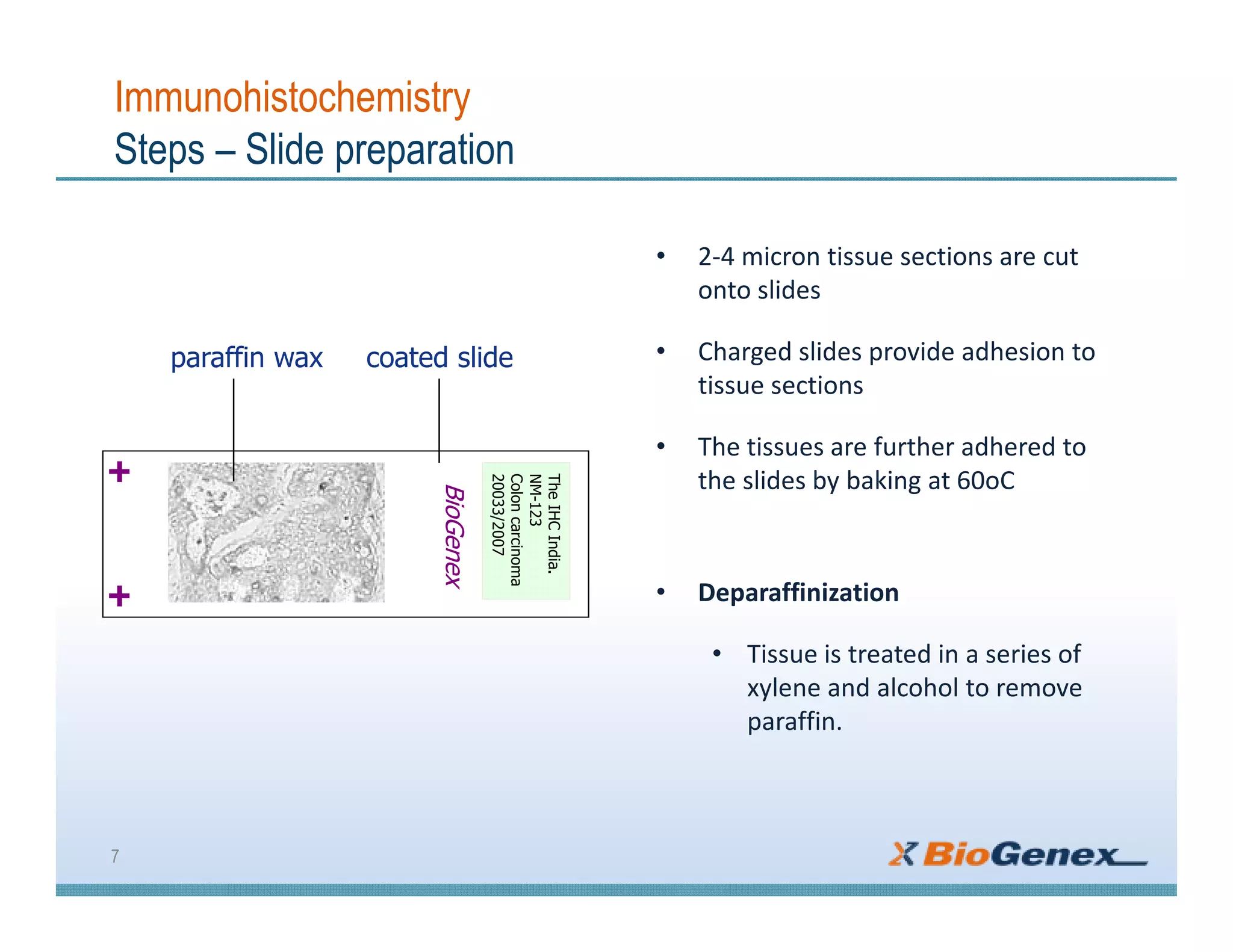 Basics of Immunohistochemistry (IHC) | PDF