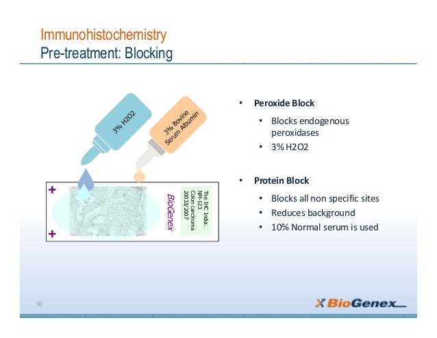 Basics of Immunohistochemistry (IHC)