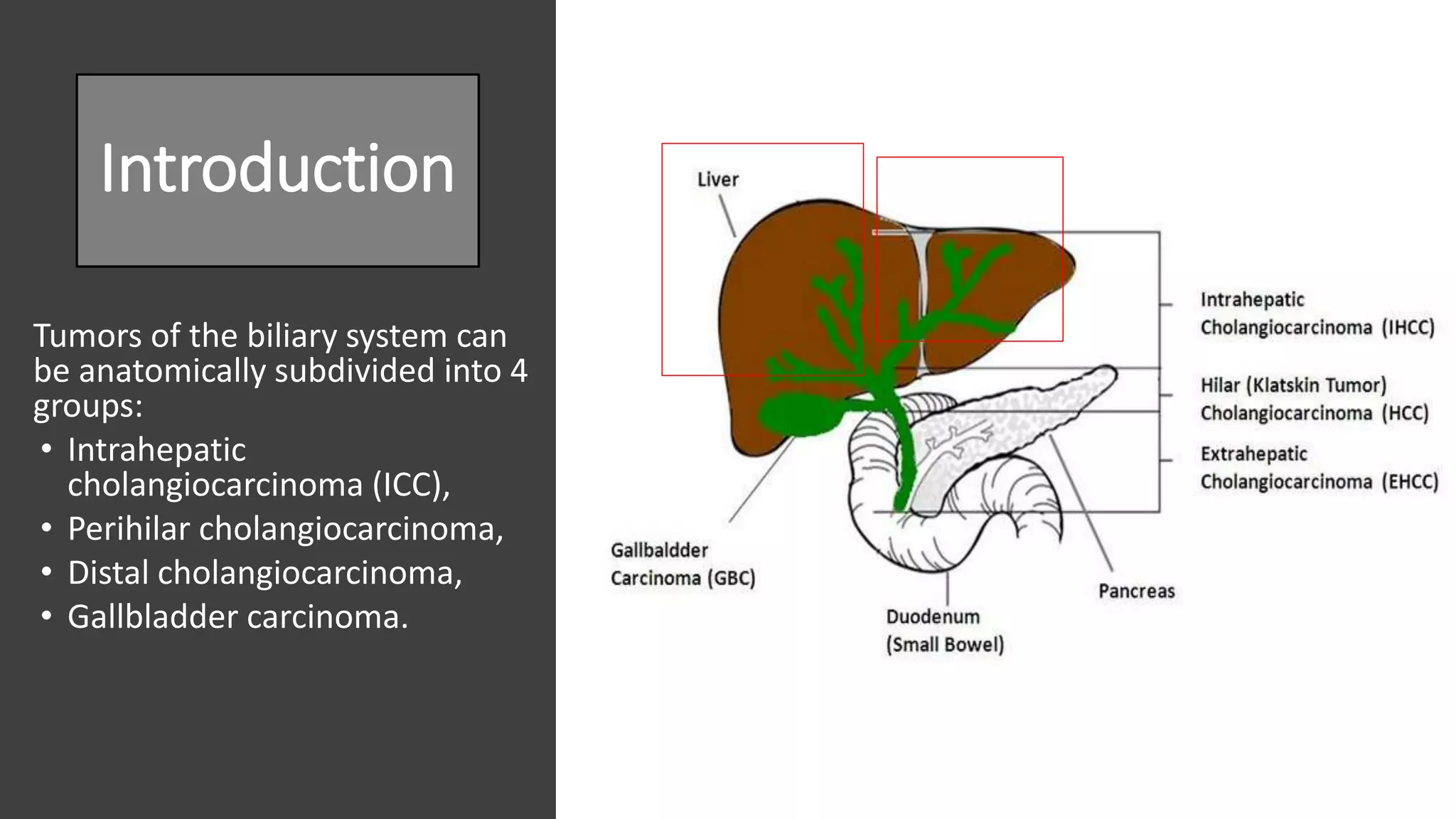 Intrahepatic cholangiocarcinoma | PPTX