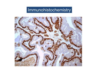 Ihc fish and flowcytometry | PPT