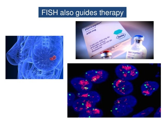 Ihc fish and flowcytometry