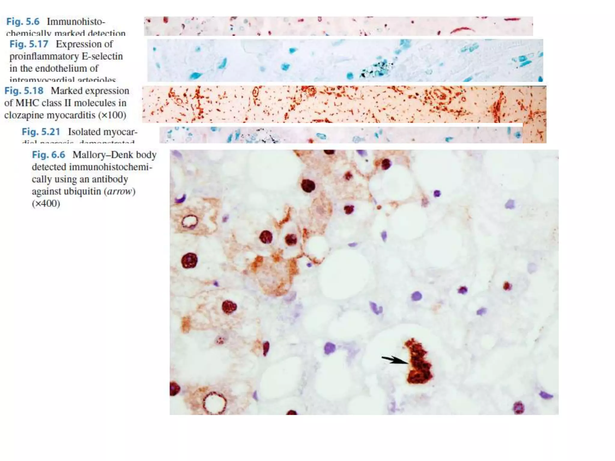 Ihc in forensic pathology | PPTX