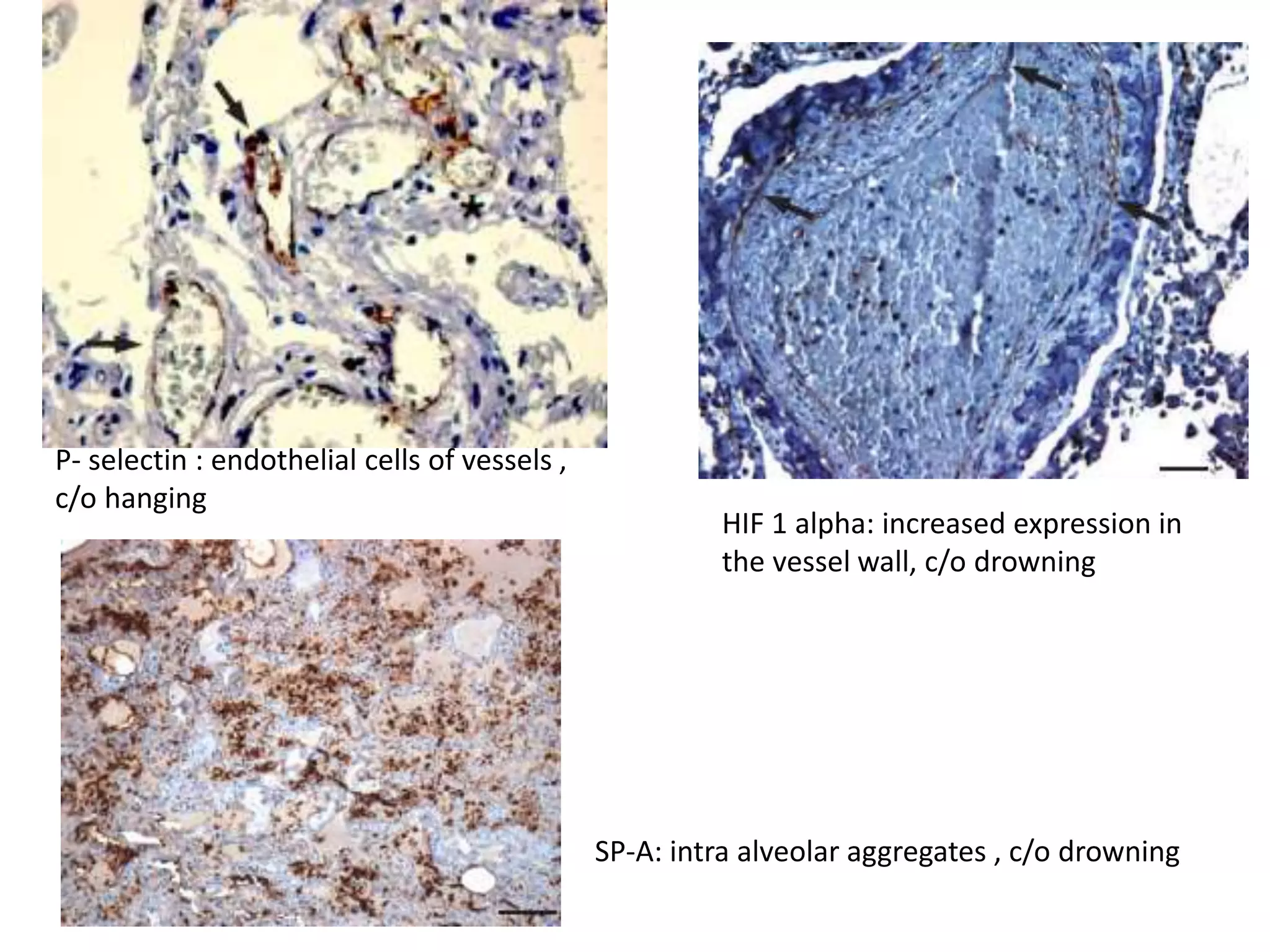 Ihc in forensic pathology | PPTX