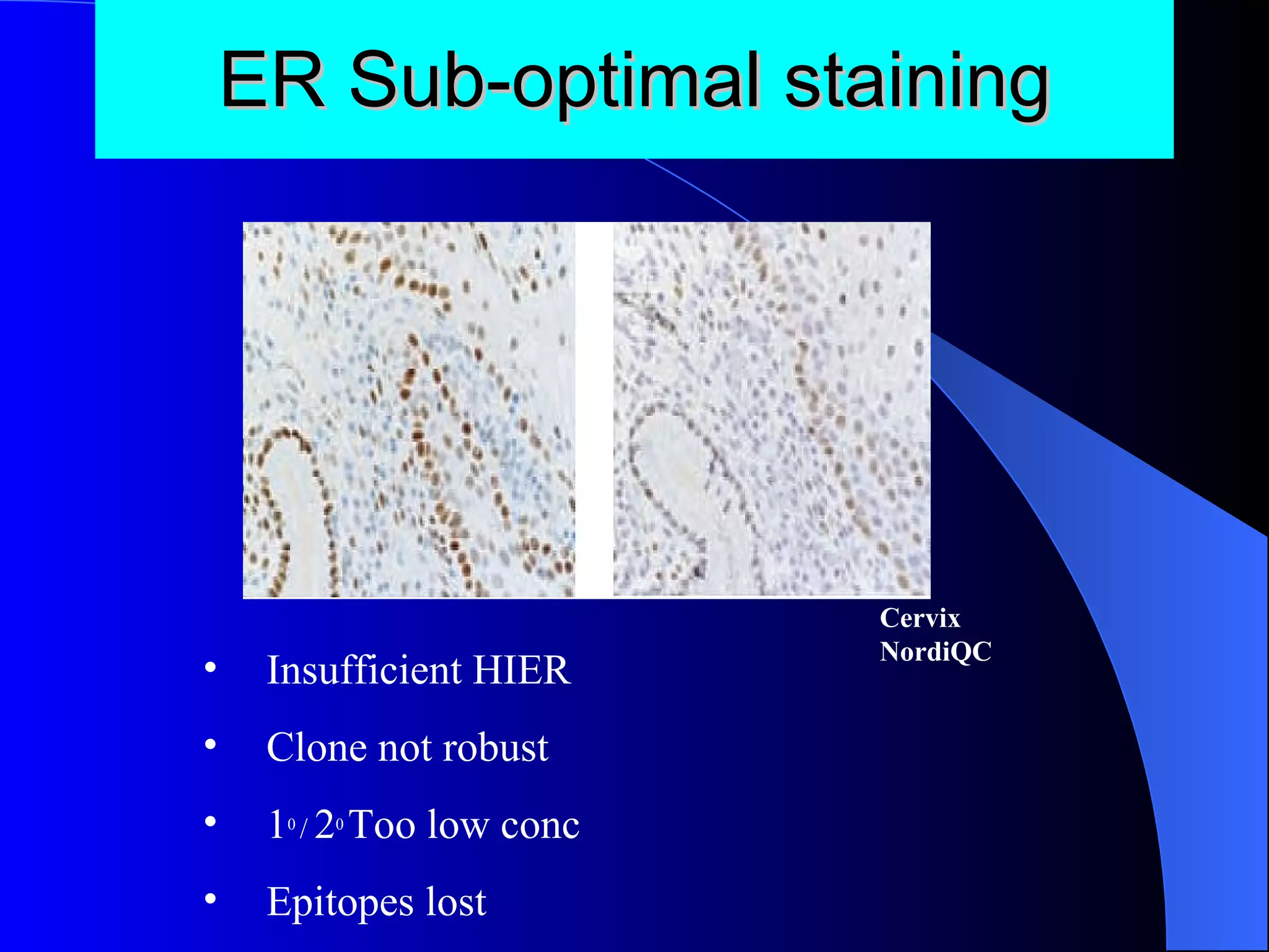 IHC Technology | PPT
