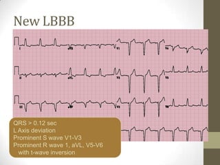 Ischemic Heart Disease | PPT
