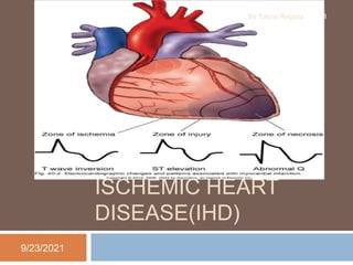 Pharmacotherapy of ischemic heart disease | PPTX