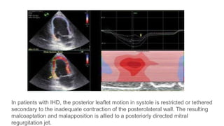 Ischemic heart Disease ethiopathogenesis, Treatment and prevention | PPT