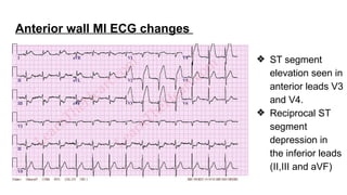 Ischemic heart Disease ethiopathogenesis, Treatment and prevention | PPTX