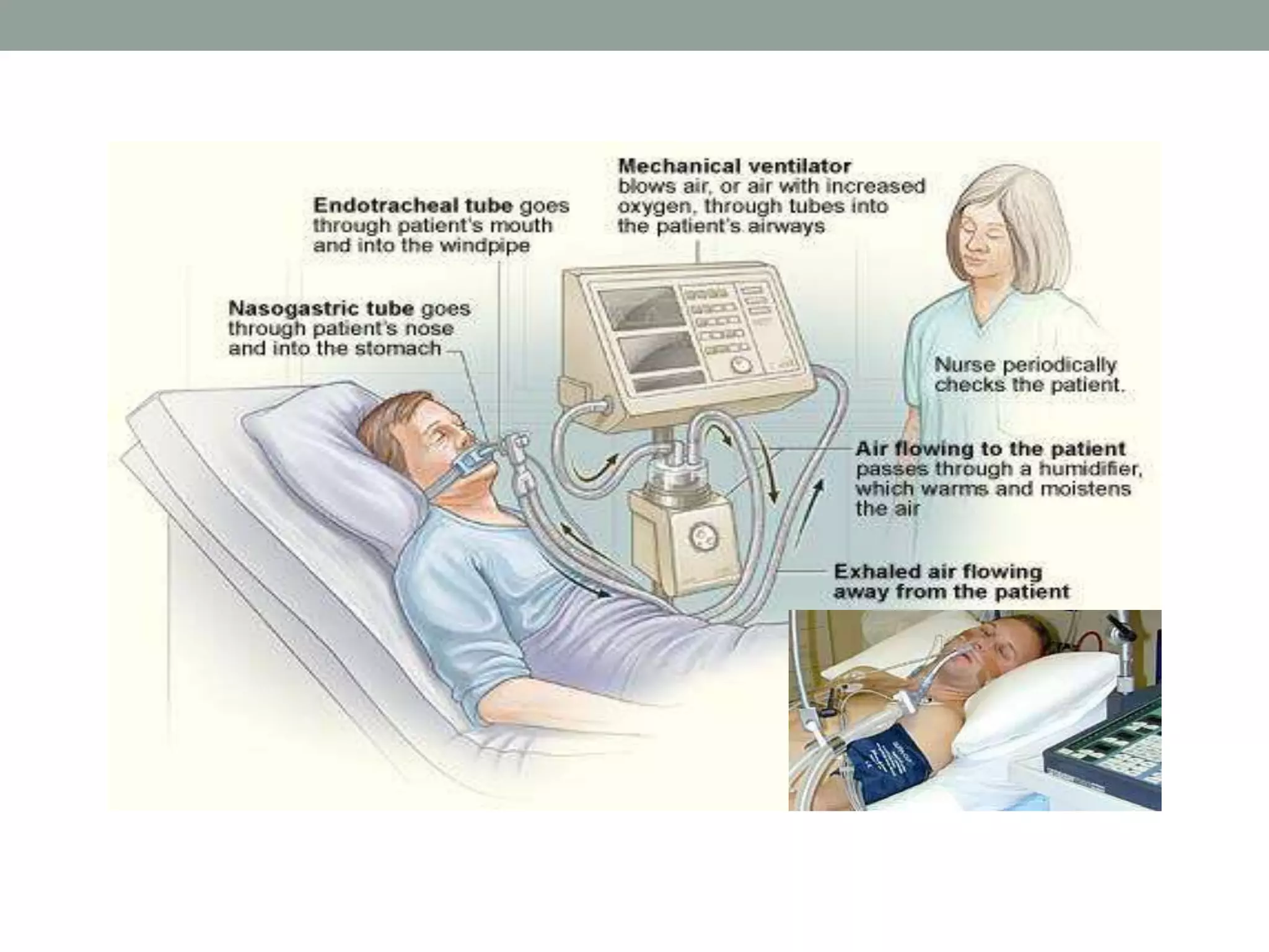 IHI devices bundles | PPT