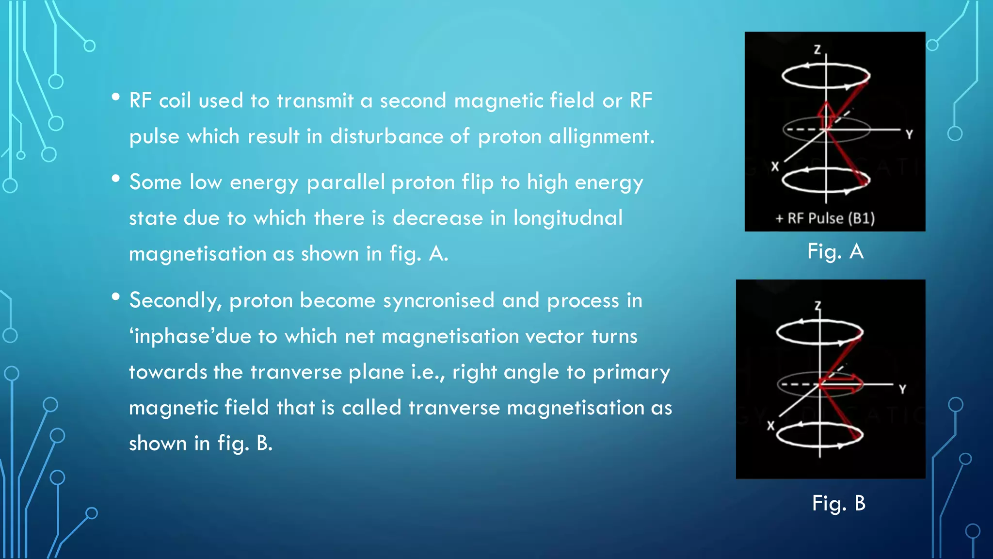 How mri scan works ? | PPT