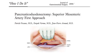 Artery first approaches to Pancreatoduodenectomy | PPTX