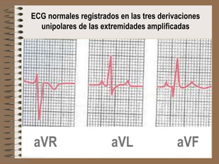 FENÓMENOS ELÉCTRICOS DEL CORAZON | PPTX